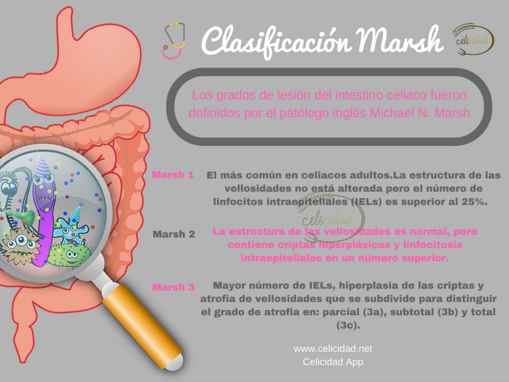 Biopsia intestinal para diagnosticar celiaquía: paso a paso